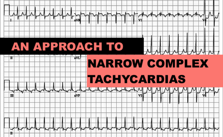Narrow Complex Tachycardias - Stronger Medicine