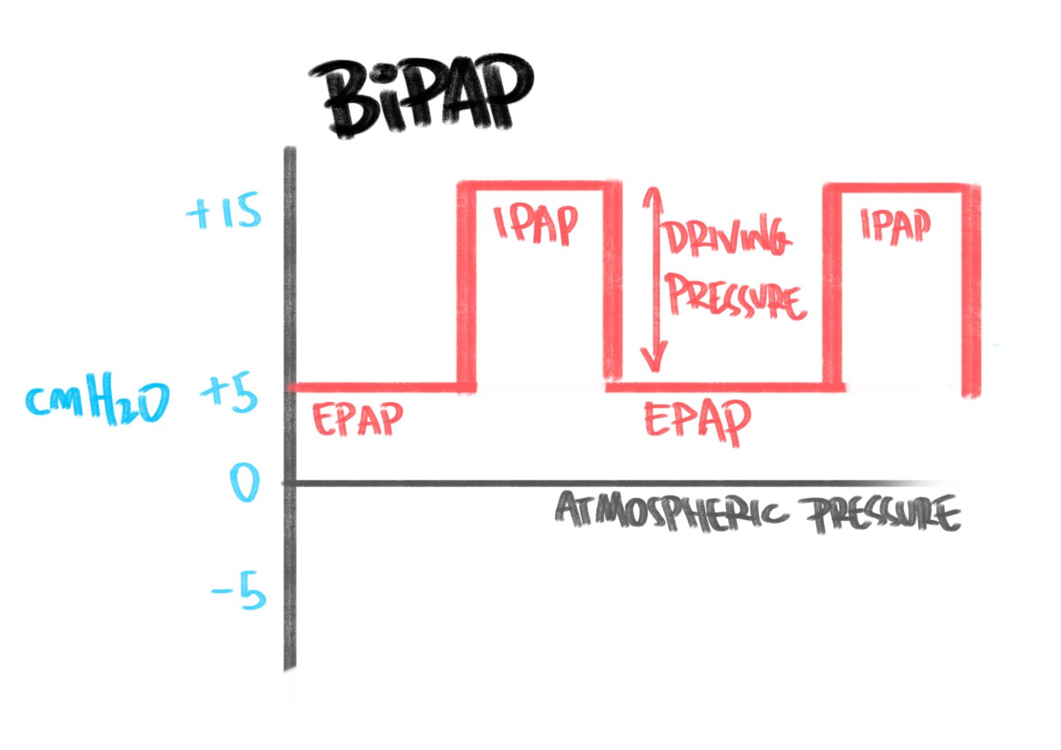 Non-Invasive Ventilation - Stronger Medicine